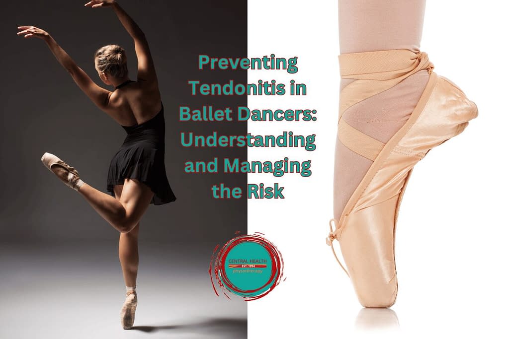Preventing Tendonitis in Ballet Dancers: Understanding and Managing the ...