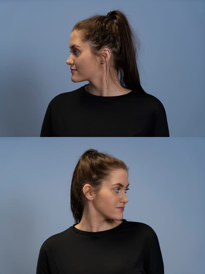 Cervical Spinal Stenosis Intermediate Exercise Programme | Central ...