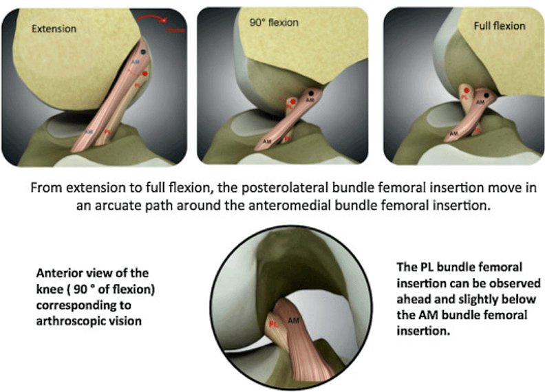 ACL Injury Part 1 - Injury, Different type of ACL Injury, Diagnosis ...
