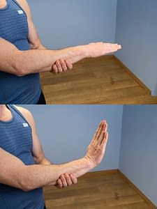 Tennis Elbow/Common Extensor Tendinopathy Early Exercise Programme ...