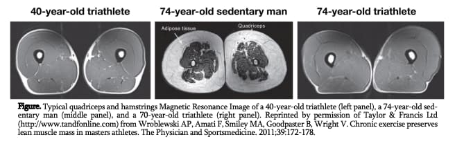 Is running bad for your knees? The Truth about joint health and running ...